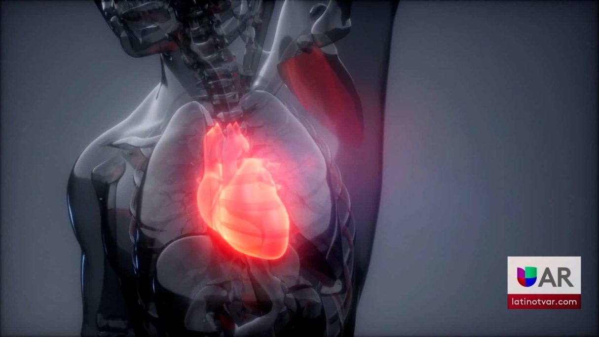 Inflamación del corazón en adolescentes. - Univision Arkansas