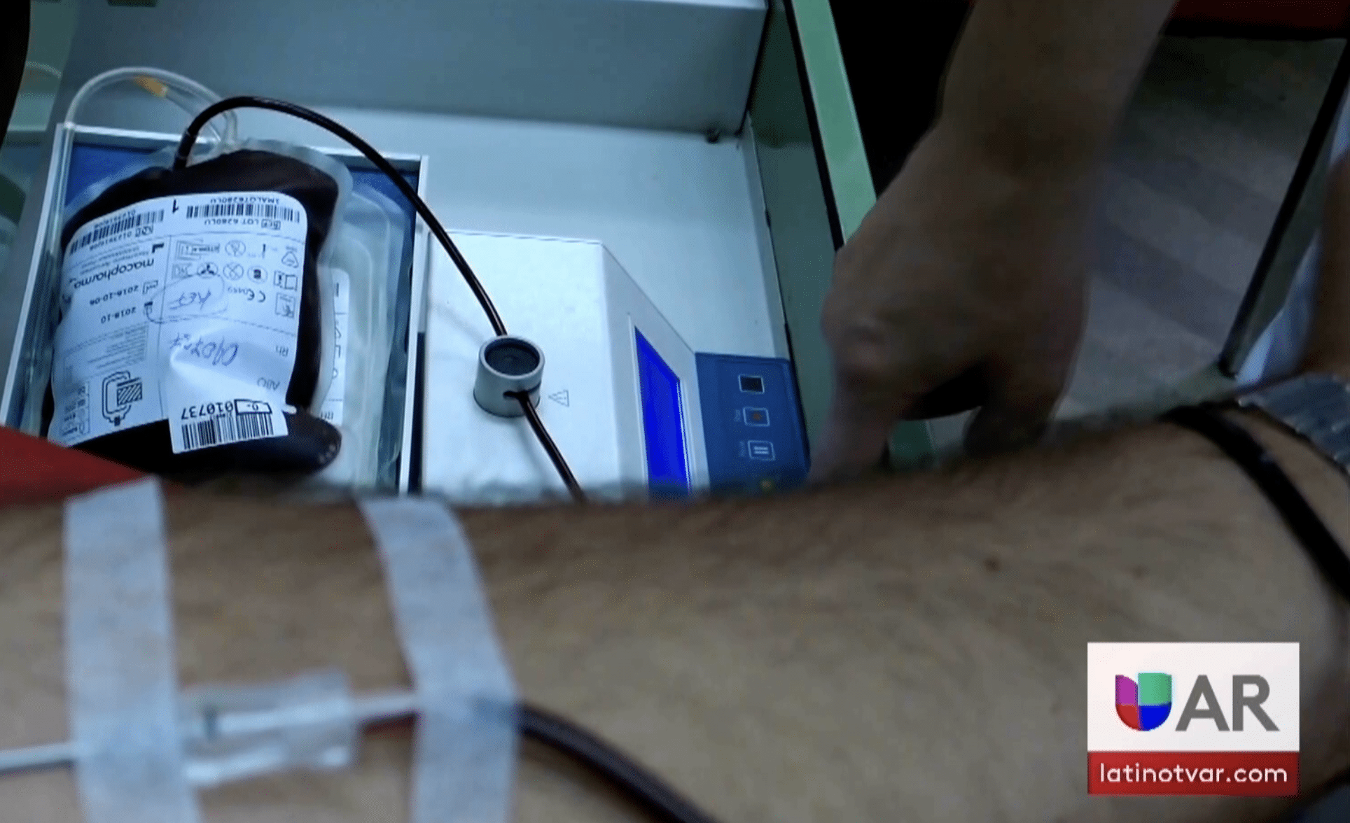 La Cruz Roja hace un llamado a donar sangre por una escasez no vista en ...