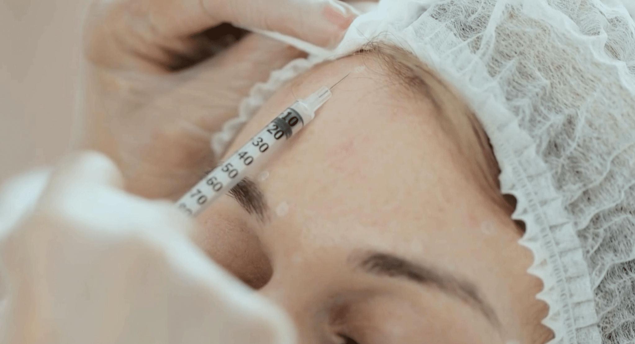 Los CDC y la FDA están investigando enfermedades relacionadas con el ...